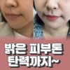 일산 정발산동 피부관리실 셀유스관리 후기 올려드려요~ 네이버 블로그
